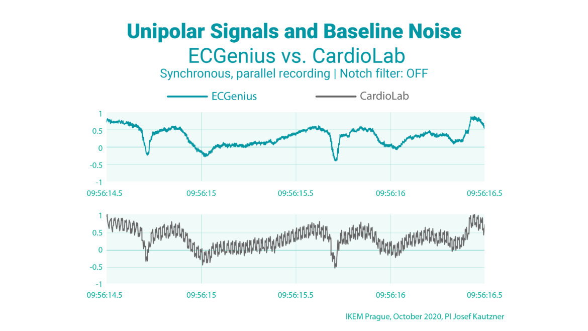 ECGenius™ System – CathVision